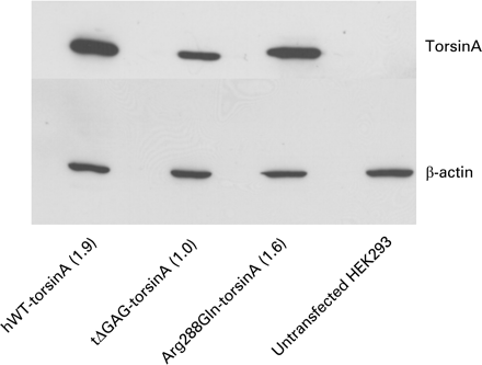 Novel TOR1A mutation p.Arg288Gln in early-onset dystonia (DYT1 ...