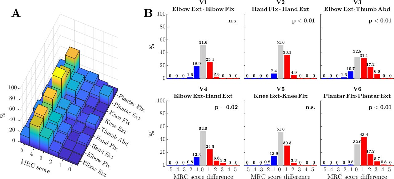 Pattern of paresis in ALS is consistent with the physiology of the ...