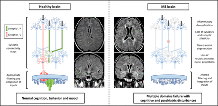 Psychiatric symptoms in multiple sclerosis: a biological perspective on ...